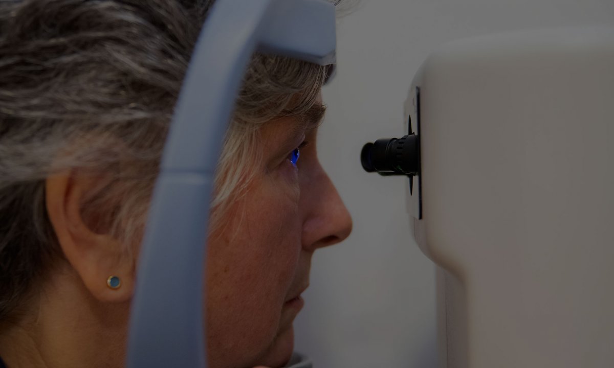 Entropio Ectropio - MV Oftalmologia